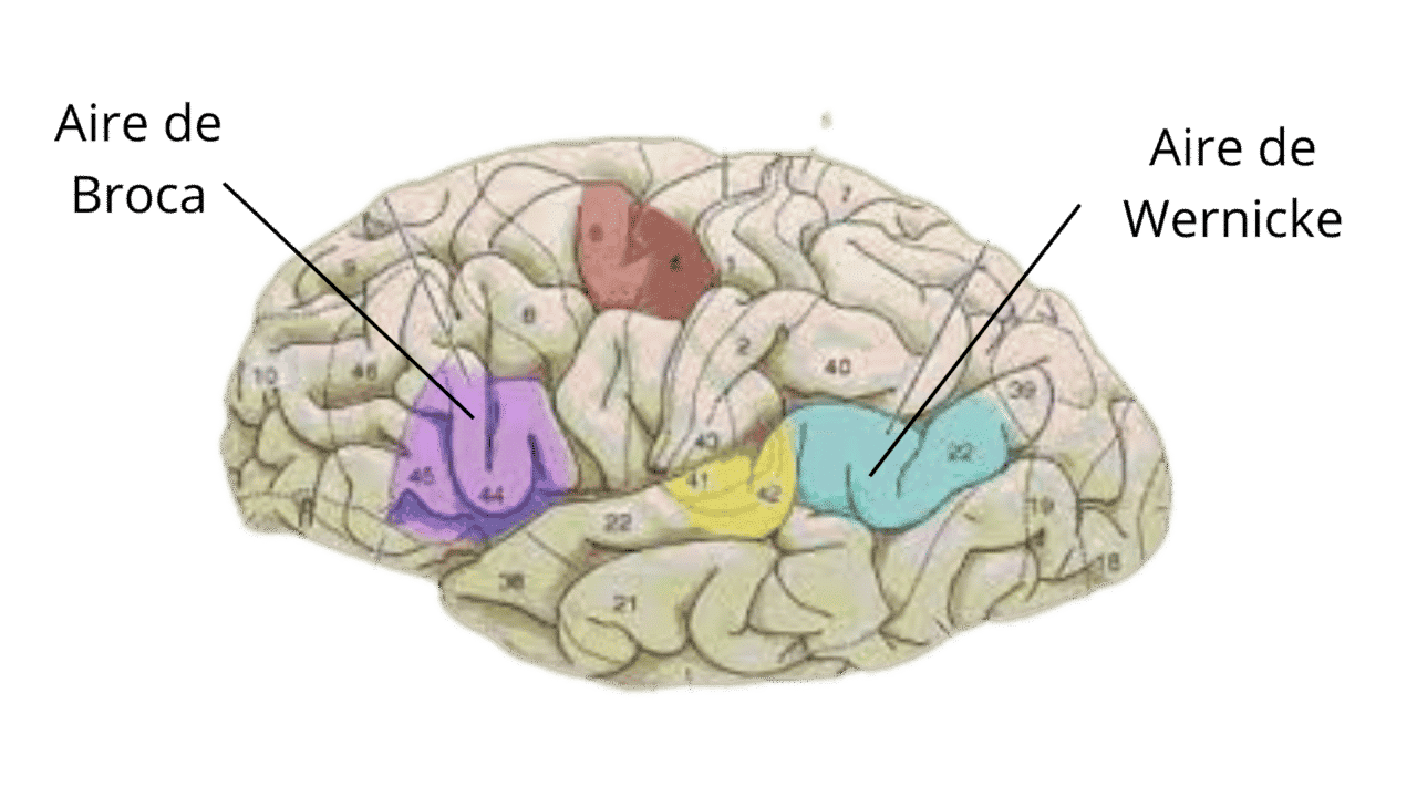 Understanding Aphasia After Stroke | DYNSEO Insights